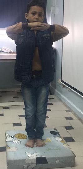 The Foam Test With Eye Open Then With Eye Closed Download Scientific