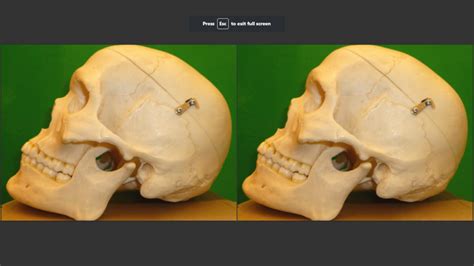 Temporal Bone Labeling Pt1 Diagram Quizlet