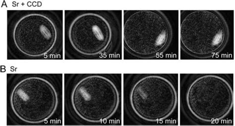 Imaging Of Mitotic Spindle Jinepol Ivf Center Turkey