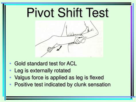 Ppt Femur Patellar Surface Femur Lateral Condyle And Epicondyle Head