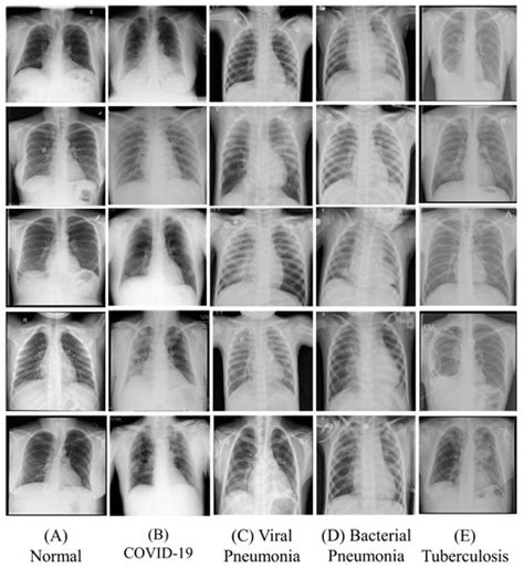 Diagnostics Free Full Text Four Types Of Multiclass Frameworks For