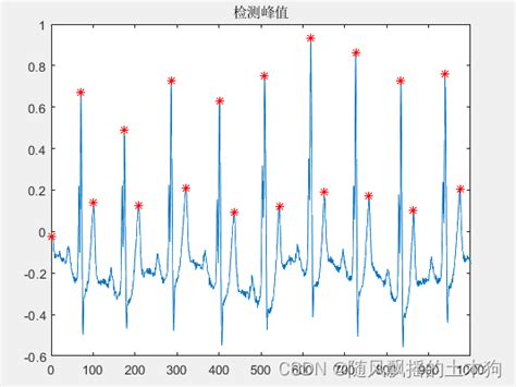 【matlab第25期】基于matlab的lstm深度学习模型的自动检测时间序列数据峰值算法 阿里云开发者社区