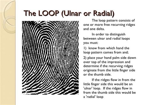 Ulnar Loop Patterns