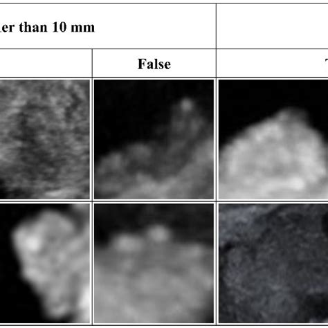 Model Prediction Results And Corresponding Images According To Gb Polyp