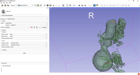 Centerline Problem Support 3d Slicer Community