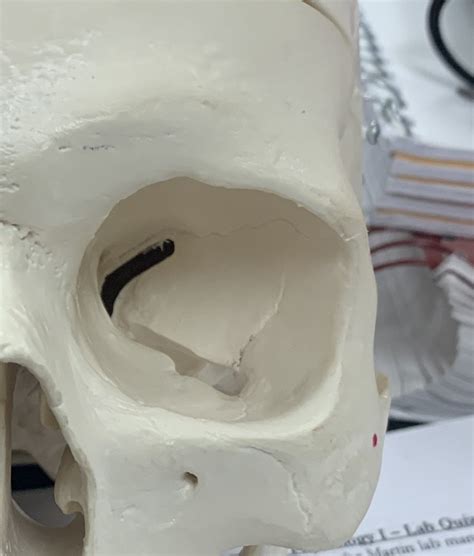 Left Orbit Anterior View Diagram Quizlet