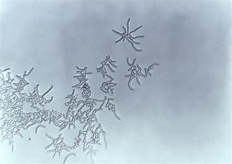 Rhodococcus Equi Wikipedia