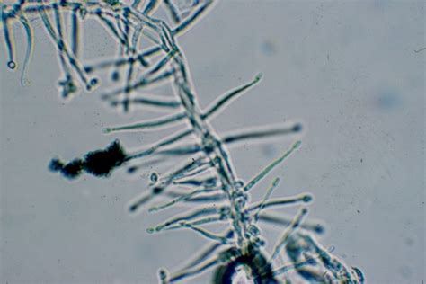 Hyphomycetes Alchetron The Free Social Encyclopedia