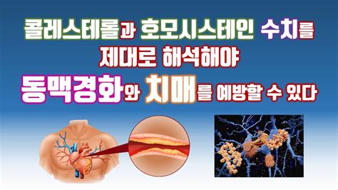 콜레스테롤 호모시스테인 바로알기 고지혈증 낮추는 방법ㅣhdl 콜레스테롤 높이는 방법ㅣ혈액 검사지의 콜레스테롤 수치와 호모