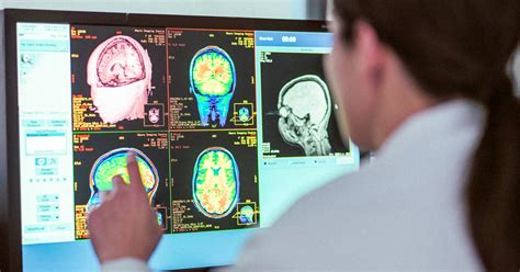 Mysterious Brain Diseases In Canada Werent A Mystery After All