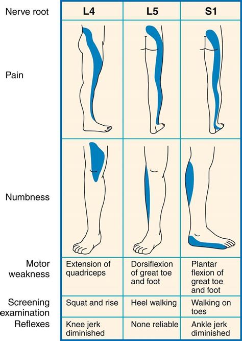 Sciatica Affects Nerve Root Pathologies Dr Jyoti Dongre Rao Posted