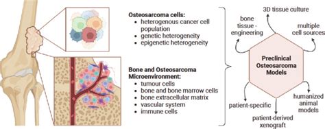 Tissue Engineered Patient Derived Osteosarcoma Models Dissecting Tumour