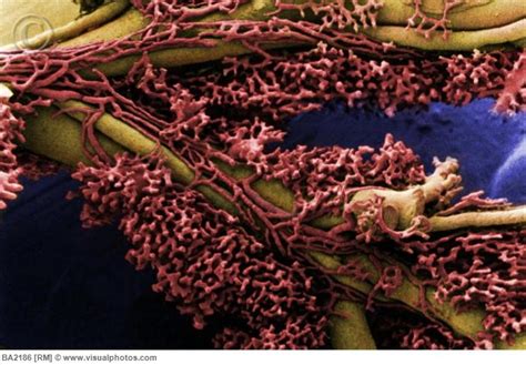 Electron Microscope Image Of Red And Green Plants