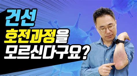 👉건선의 원인 치료후 호전과정을 정확히 알려드립니다 👈호전과정을 알아야 이 길이 맞는 길인지를 알죠 Youtube