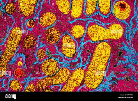 Electron Micrograph Liver Cell Fotos Und Bildmaterial In Hoher Auflösung Alamy