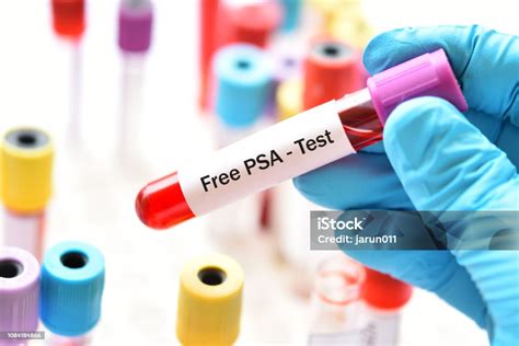 혈액 샘플 무료 Psa 테스트 건강 진단에 대한 스톡 사진 및 기타 이미지 건강 진단 전립선 특이 항원 과학 실험