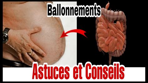 Ballonnements Astuces Et Conseils Pour DÉgonfler Votre Ventre