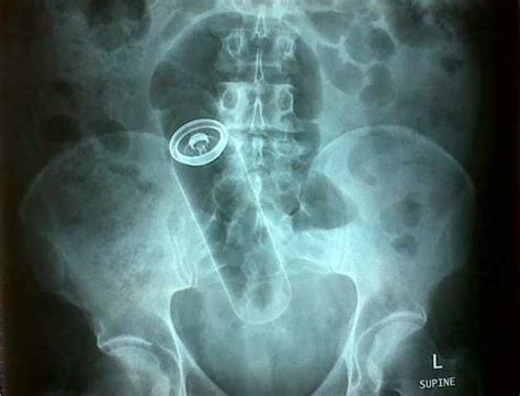 Sexual Gratification Gone Too Far Faxo