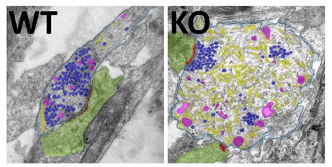 Surprising Insights Into The Role Of Autophagy In Neuron Science Codex
