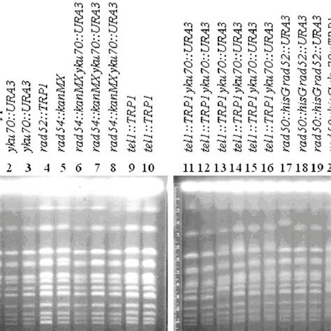 Chromosomal Pattern From Pulsed Field Gel Electrophoresis Download Table