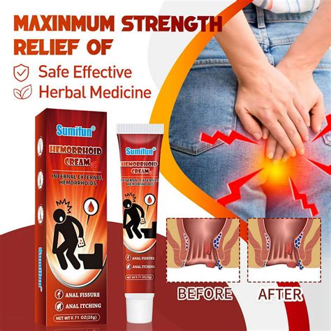 Ungüento Para Hemorroides Ungüento Para Hemorroides Rotas Hemorroides Mixtas Internas Y Externas