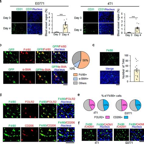 Infiltration Of Mammary Gland Tissue Resident Macrophages Mgtrms In