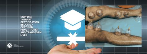 Cupping Therapy Certification Become A Certified Practitioner And