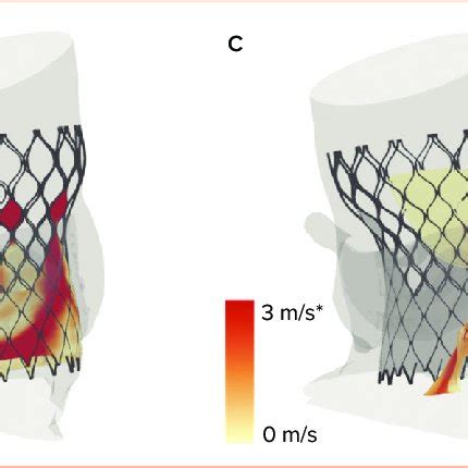 Computational Fluid Dynamics Simulation Download Scientific Diagram