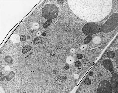 Cytokinesis In Plant Cells Microscope