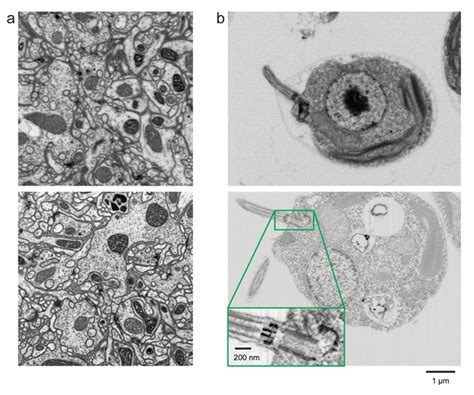 Figures And Data In Enhanced Fib Sem Systems For Large Volume 3d Imaging Elife