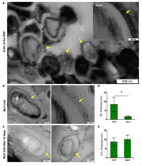 Figure 1 From Mycobacterium Tuberculosis Cells Surviving In The Continued Presence Of