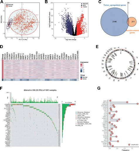 Anoikis Related Gene Signature Is Associated With Immune Infiltration