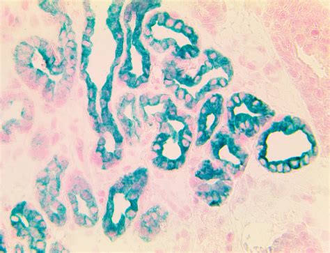 Mohs Polydetector Hrp Green Ihc Detection System Bio Sb