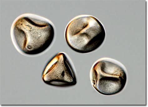 Molecular Expressions Microscopy Primer Specialized Microscopy Techniques Differential