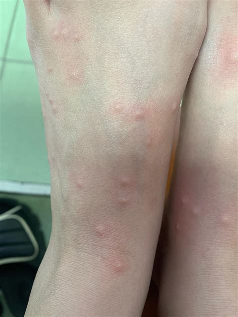 cứu em các bảnh ơi chuyện là em qua trọ mới ở thì ở đây có mấy bạn nuôi