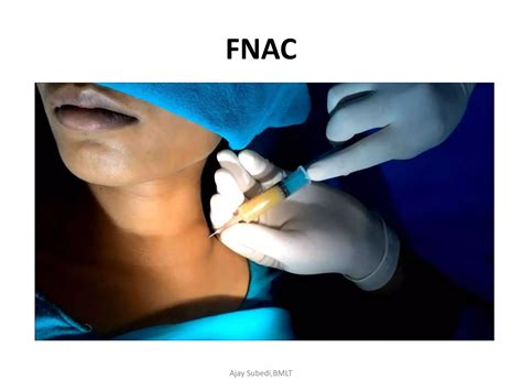 Pyogenic Infectionpptx