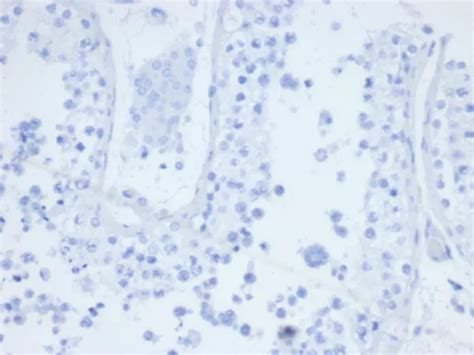 Cd21 Mature B Cell And Follicular Dendritic Cell Marker Clone 1380