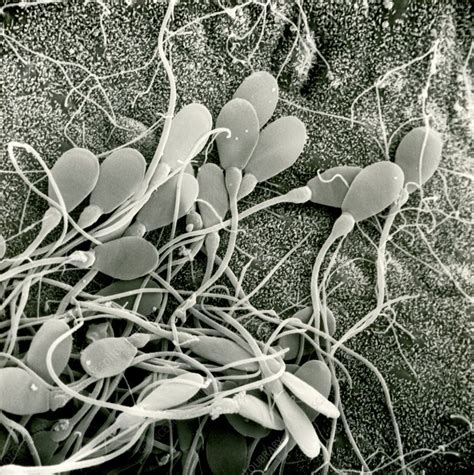 Spermatozoa SEM Stock Image C Science Photo Library