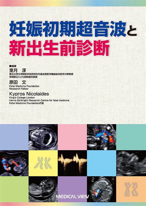 骨系統疾患 出生前診断と周産期管理 健康医学