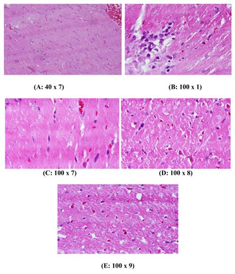 Gnps Treated Rat Received 100 μl Of 10 Nm Particles For 7 Days