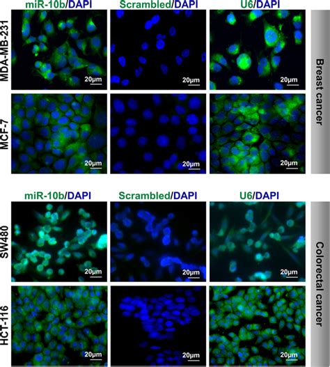 Mir 10b Expression Analysis In Breast And Colorectal Cancer Cell Lines