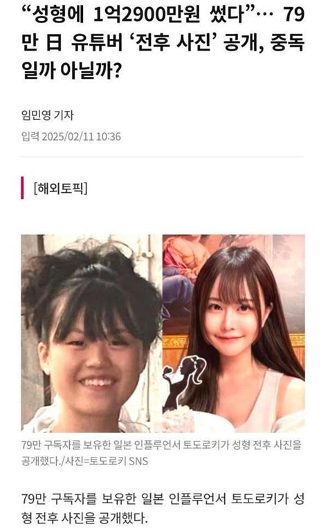 성형에 1억2900만원 쓴 일본유튜버