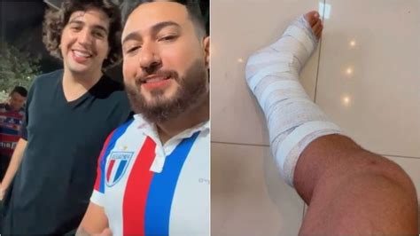 Fã De Nattanzinho Do Hit Tem Cabaré Essa Noite Torce O Pé Ao Lado
