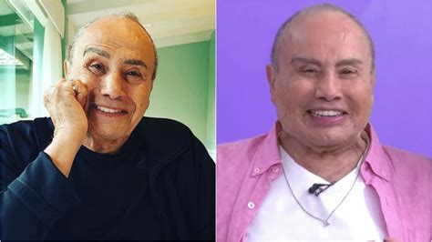 Stênio Garcia não foi o único veja harmonização facial de famosos que