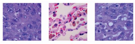 Figure 1 From Vision Transformer Based Classification For Lung And Colon Cancer Using