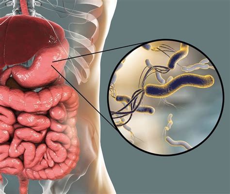 Signs You Have A Stomach Bug