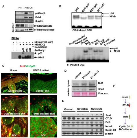 Activation Of Non Canonical Nfκb Signaling Pathway In Human And Murine