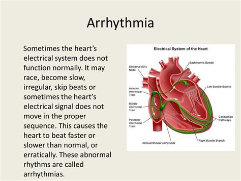 Different Types Of Heart Disease