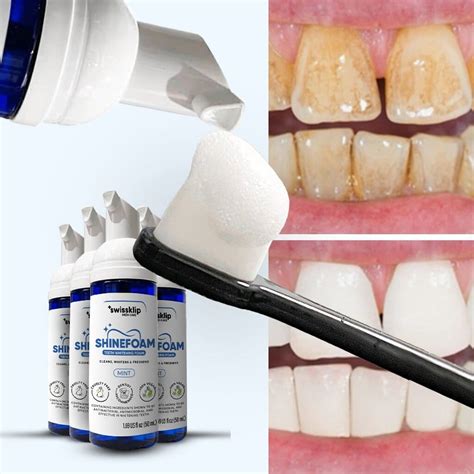 Swissklip Teeth Whitening Foam Set Swissklip