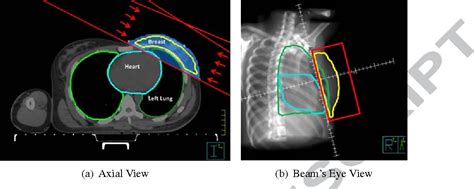 Figure 1 From A Robust Cvar Optimization Approach With Application To